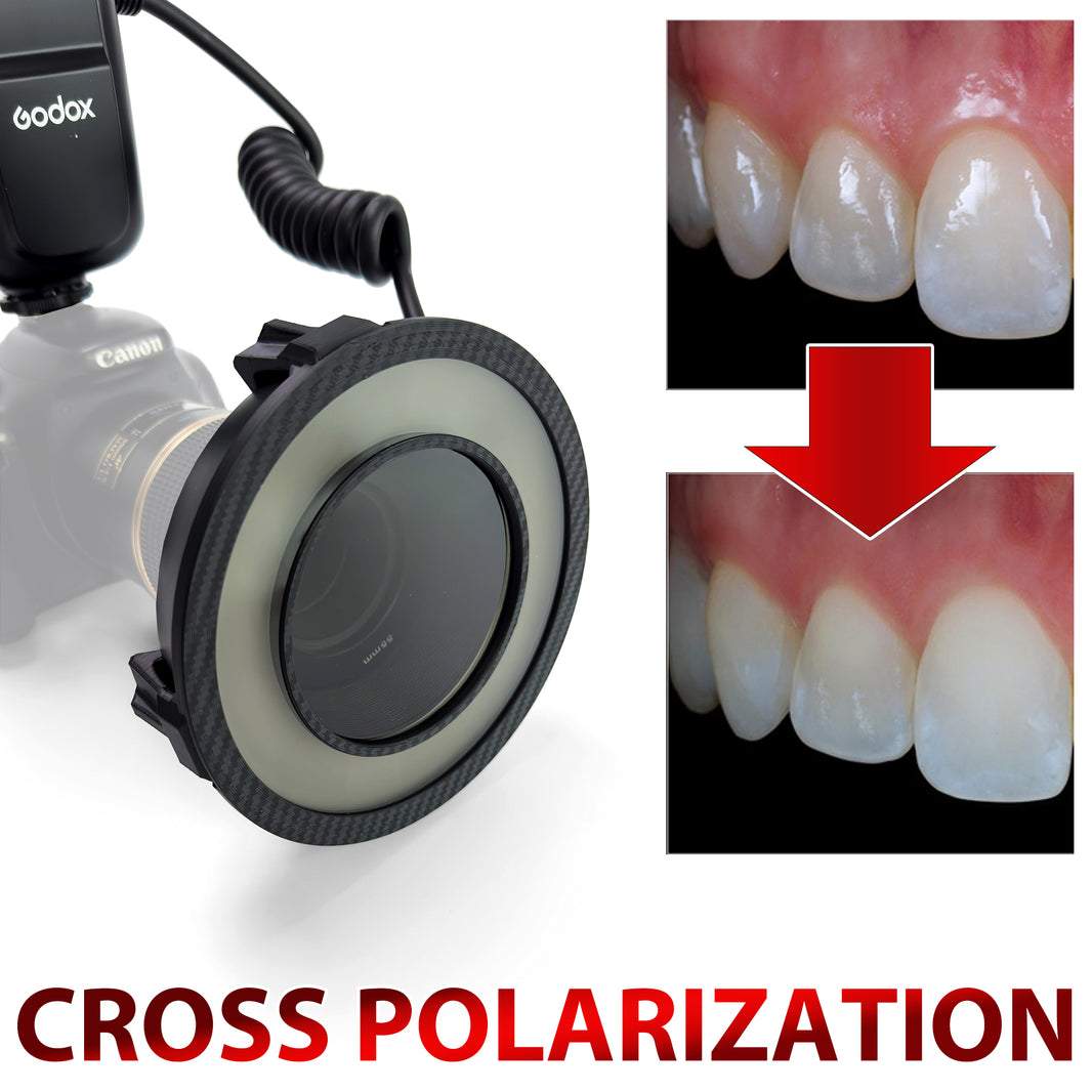 Camera Brackets and Flashes – Dental-photo